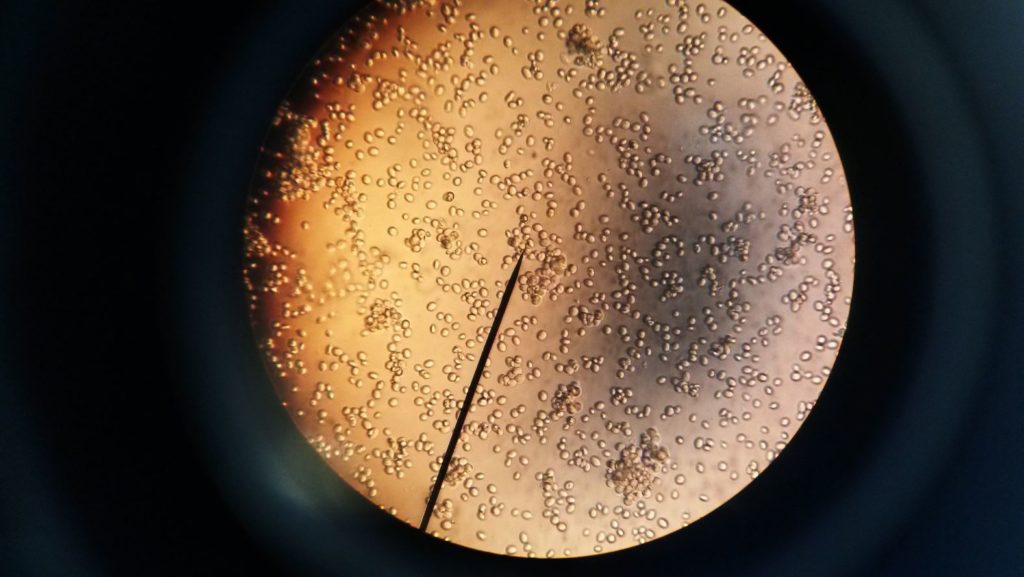 Genschalter in Hefe gefunden, der Mutation von 12 Genen möglich machte